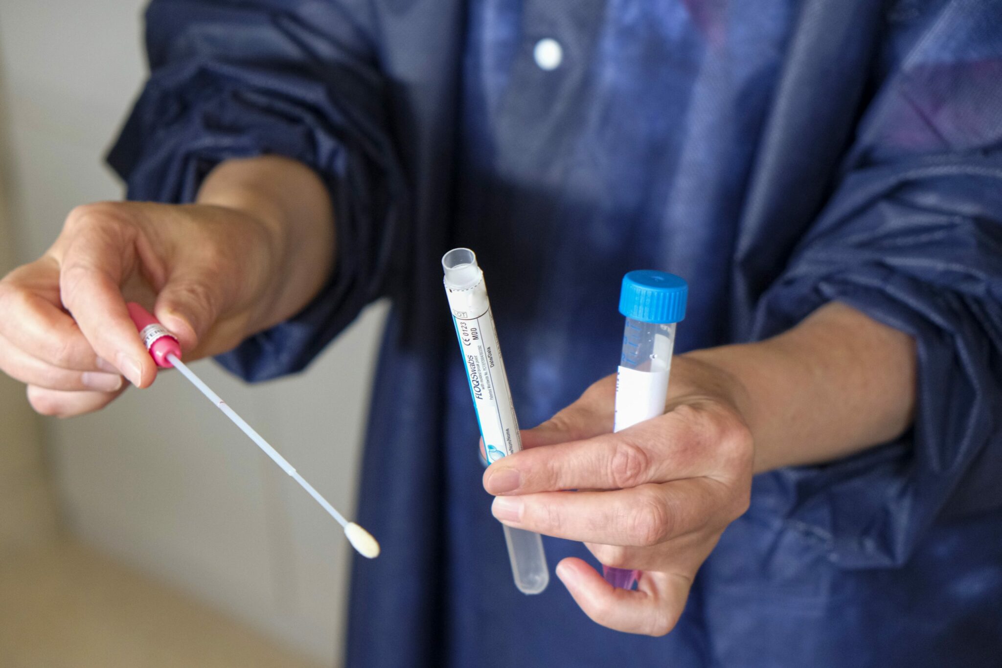 Interpretação do exame de COVID-19: entenda o seu resultado | Hilab ...