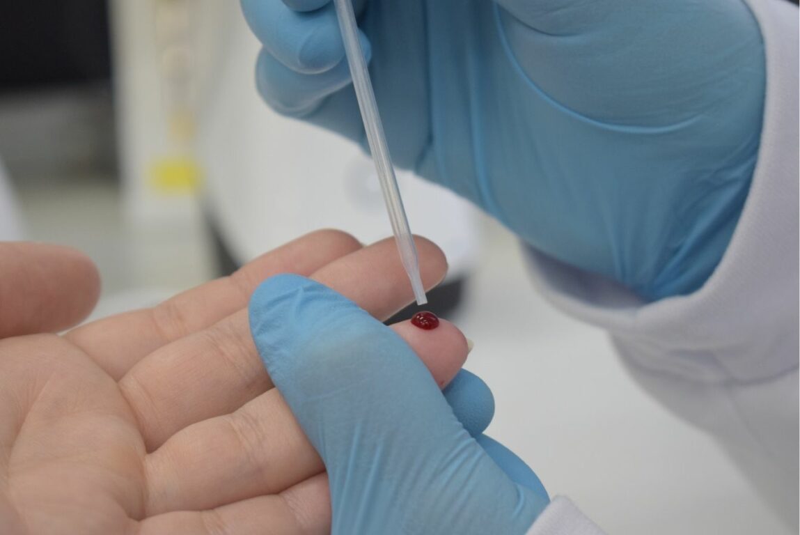 Exame HBsAg para Hepatite B: Por que fazer e como interpretar? | Hilab: Exames Point-of-Care ...